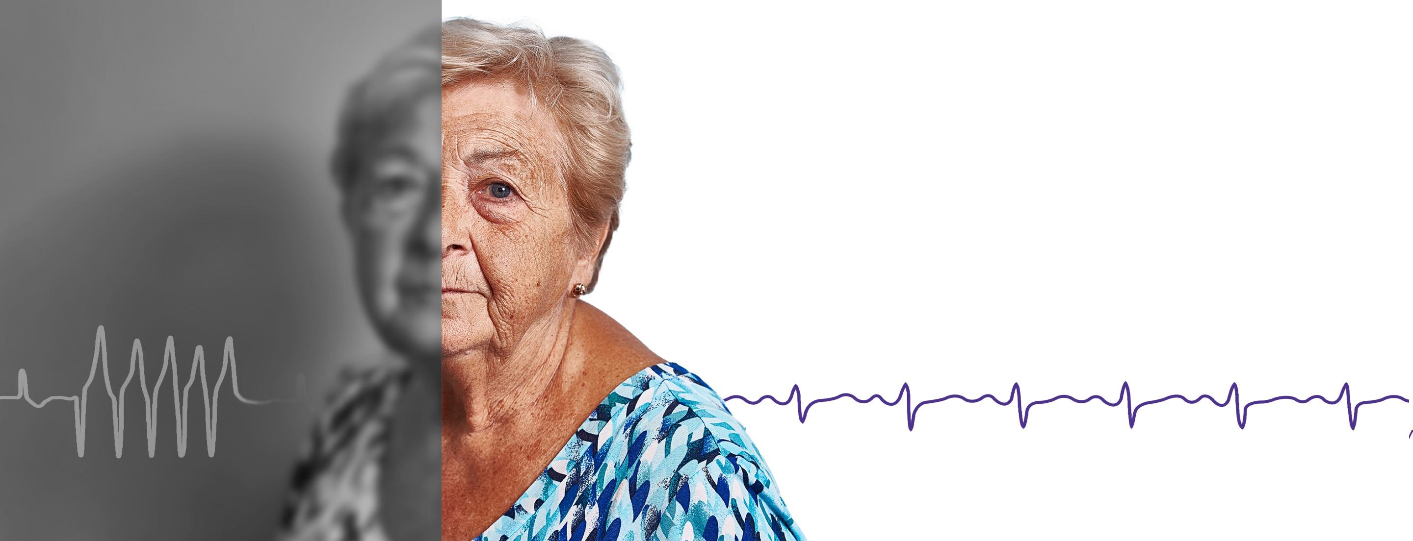 DIGIFab: Digoxin Immune Fab | Digoxin Toxicity Treatment | DIGIFab